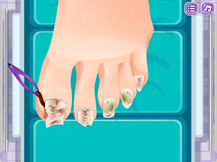 Blonde Sofia: Ingrown Toenail - Play Now on Y8.com
